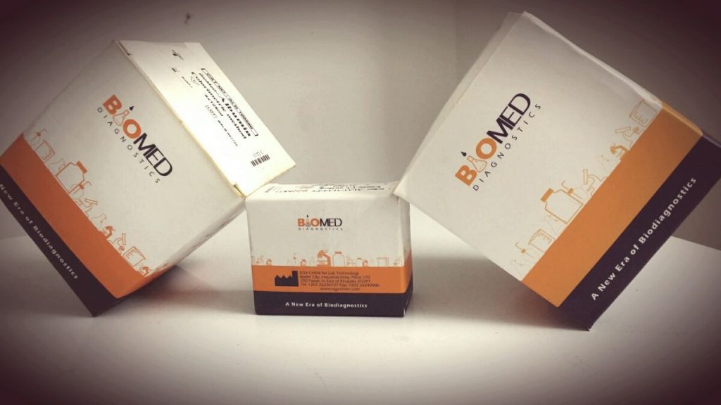 ASOT Latex with positive & negative control 100 test | Lab Supply